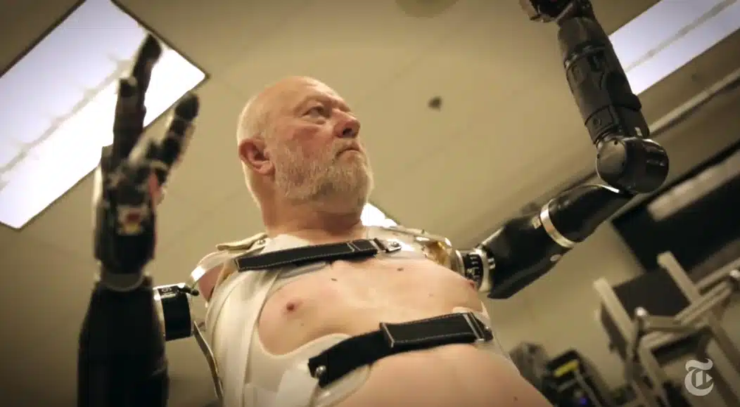 Meet Les Baugh, the world's first bionic man | KnowTechie