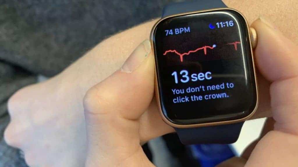 Study finds regular detection of irregular heartbeats with the Apple Watch